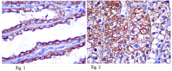 Anti-Bak (NT) Antibody | ABC12